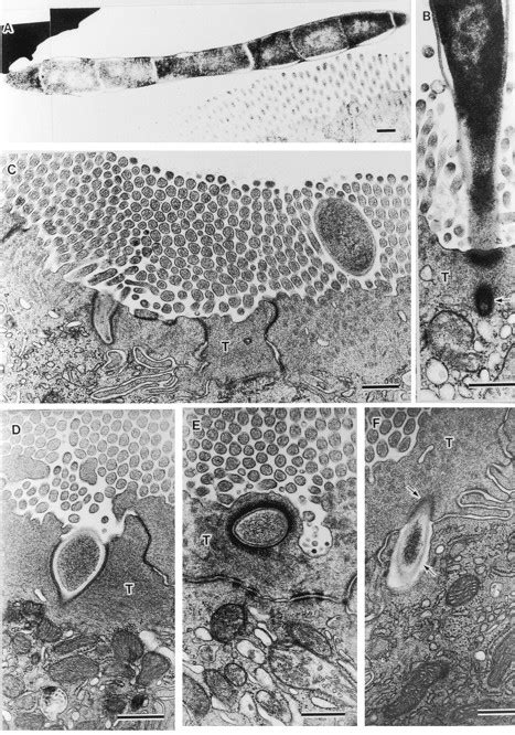 Phagocytosis Microscope