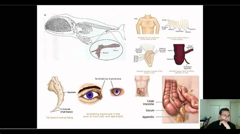 What Are Human Vestigial Structures At Anthony Soto Blog