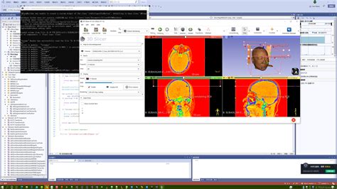 windows 10中编译调试3d slicer过程记录 win10 slicer 编译 csdn博客