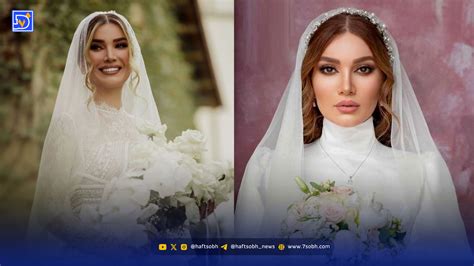 استایل عکس های قبل و بعد عمل زیبایی متین ستوده روزنامه هفت صبح