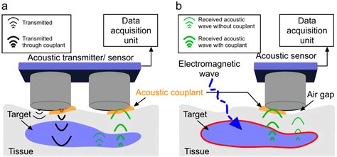 What Is A Coupling Agent Ultrasound At Jimmy Milam Blog