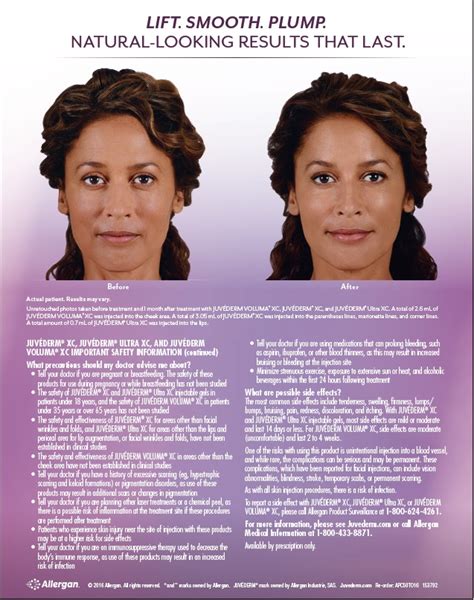 JuvÉderm® The Vu Center