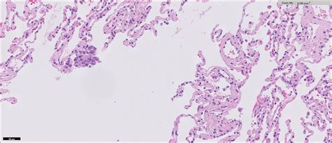 Vgh Stas Object Detection Dataset And Pre Trained Model By Nycu