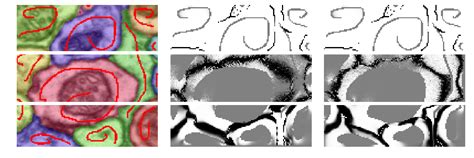 End To End Learned Random Walker For Seeded Image Segmentation Deepai