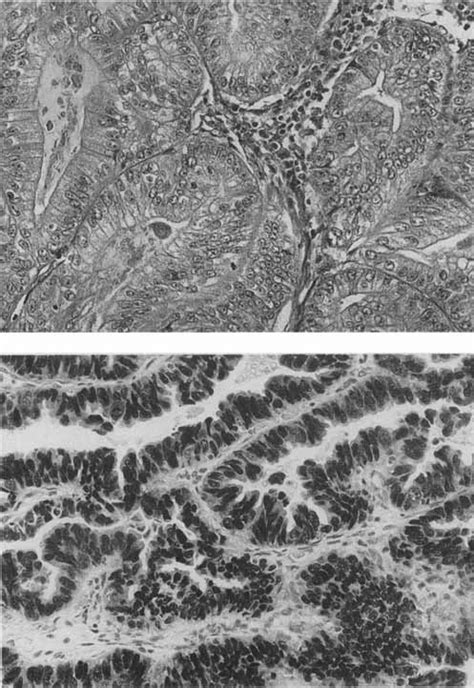 Example Of Single Strand Conformation Polymorphism Sscp And Dna Download Scientific Diagram