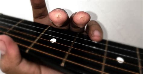 Guitar Calluses Best Recommendations Helpful Guide