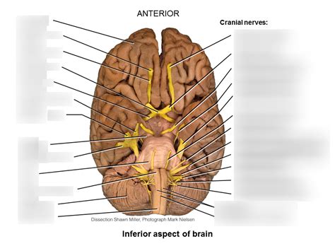 Inferior Brain Diagram Cerebrum Overview