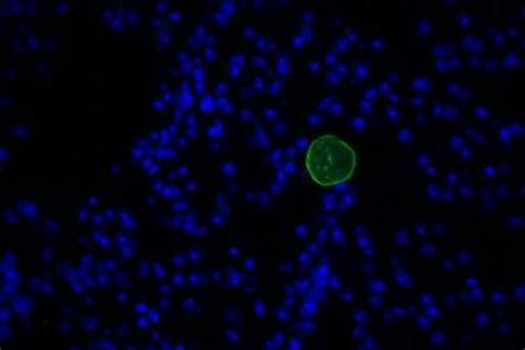 Is The Brain Parasite ‘toxoplasma Manipulating Your Behavior Or Is