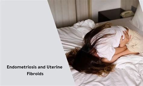 Understanding Endometriosis And Uterine Fibroids London Fibroid Clinic