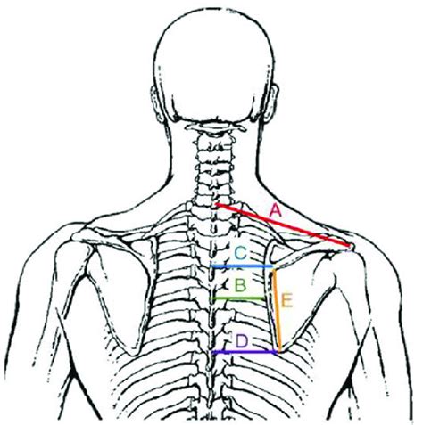 Landmarks Of Measurement Of Scapular Range Of Motion A Distance Download Scientific Diagram