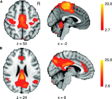 Resting State Networks Ica Derived Group Mean A Motor Resting State