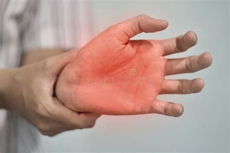 Painful Palm Of Asian Man Concept Of Compartment Syndrome Cellulitis