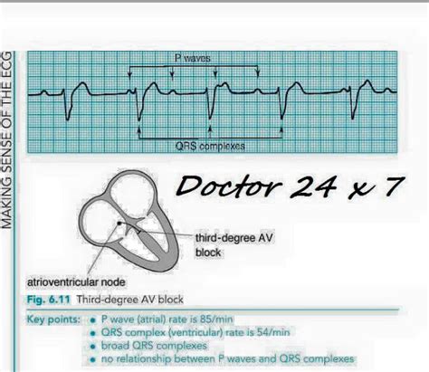 Amudu Easy Way To Learn Ecg Step By Step In A Very Easy Way