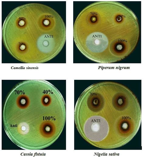 Antibacterial Activity Of Plants Extract By Agar Well Diffusion Download Scientific Diagram