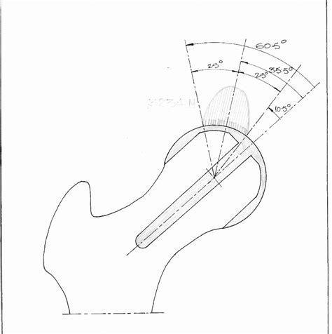 Figure 10 From Finite Element Analysis Of The Femoral Head Semantic