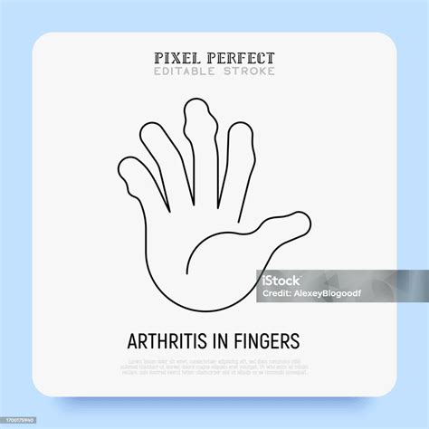 손가락에 관절염 얇은 선 아이콘입니다 관절의 염증 관절염 픽셀 완벽 편집 가능한 스트로크 벡터 그림입니다 건강관리와 의술에 대한