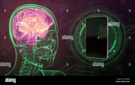 Rontgen Human Head Image Cell Phone Brain Danger By 5g Communication