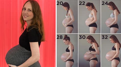 Triplets Pregnancy Progression