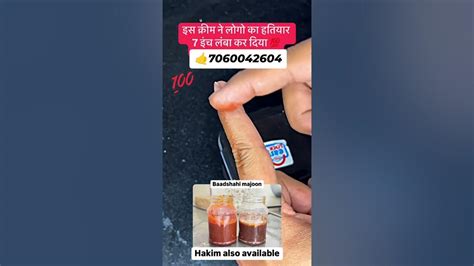 Sexualhealth Sexeducation Sexualwellness Health Sexpositive Menshealth Hsv Free Sex