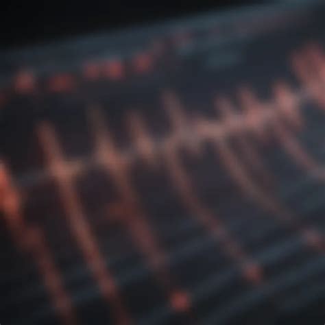 Understanding Abnormal Ekg Readings In Depth