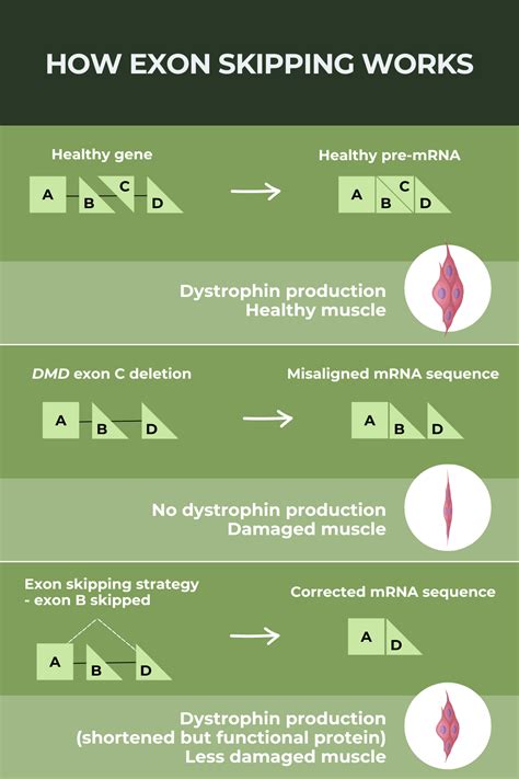 Dmd Treatment Exon Skipping Therapies Muscular Dystrophy News