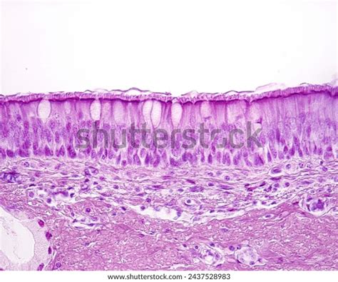 Stratified Columnar Nonciliated