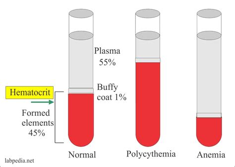 Haemoglobin Part 5 Hematocrit Hct Hct Packed Cell Volume Pcv