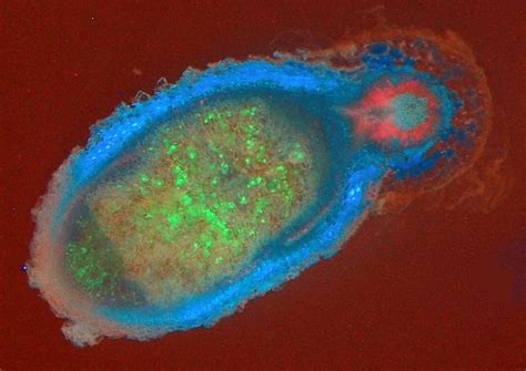 Symposium On Host Microbiome Interactions From Structure To Function Anu Research School Of