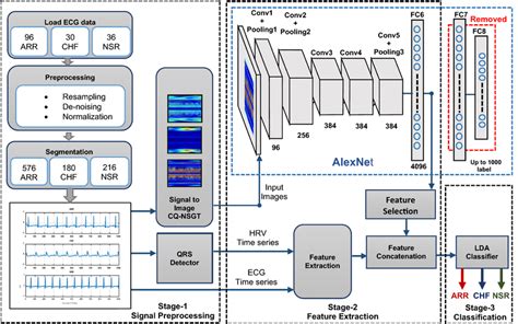 The Architecture Of The Proposed Ecg Multi Class Diagnosis System Download Scientific Diagram
