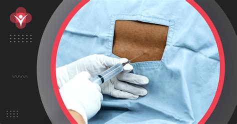 Bloqueio De Nervos Informe Se Pode Haver Um No Seu Futuro Dor Crônica O Blog