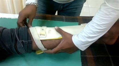 Use Of Splint In Fracture At Sophia Shellshear Blog