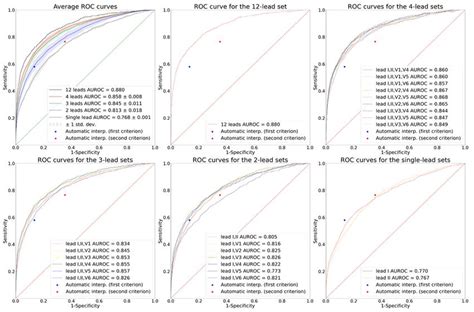 Automated Detection Of Acute Myocardial Infarction Using Asynchronous