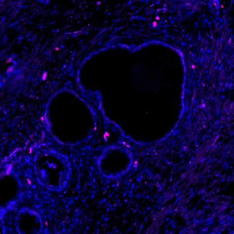 Cd8 Markers Precise Tools For T Cell Research Omicsveu