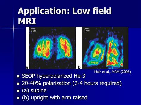 Ppt Hyperpolarized Mri Powerpoint Presentation Free Download Id 344631