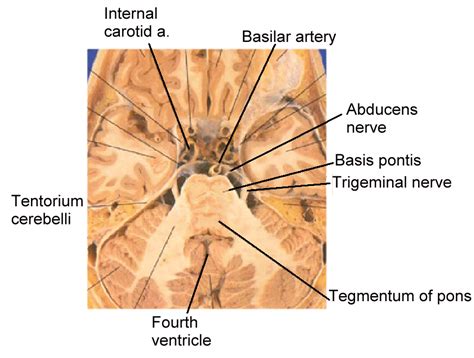 Nerve Pain Ophthalmic Nerve Pain