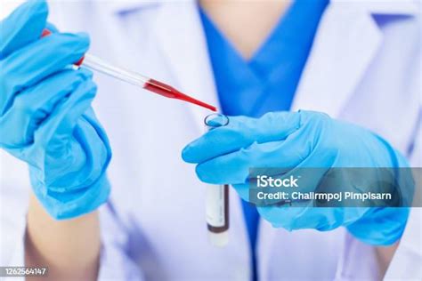 실험실 바이러스 분석에서 혈액 샘플을 분석하는 기술자 과학자 19에 대한 스톡 사진 및 기타 이미지 19 Dna Stem