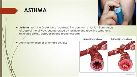 Multifactorial Disorders Pptx Genetics Science