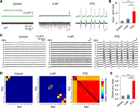 Brain Wide Network Synchronization A Representative Whole Brain Download Scientific Diagram