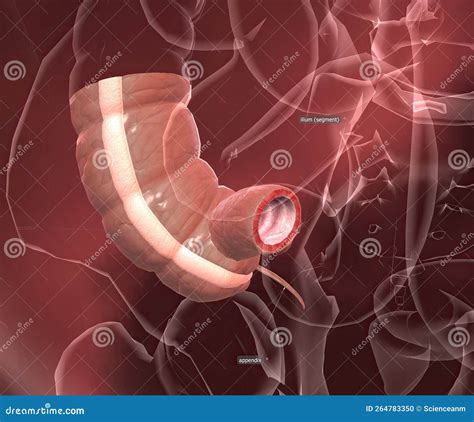 Appendicitis Is A Painful Swelling Of The Appendix Stock Illustration