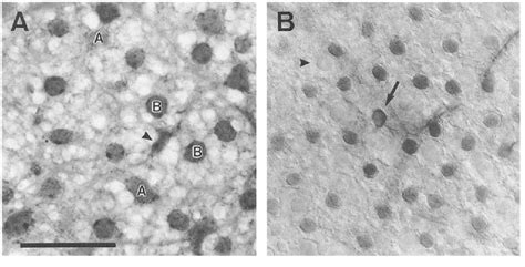 Figure From Horizontal Cells In The Cone Dominated Tree Shrew Retina Morphology