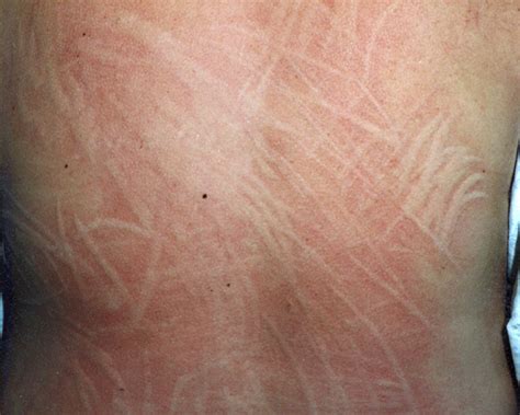 Skin Writing Medizzy Journal