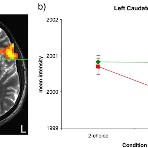 Left Prefrontal Cortex Activation Across Conditions A The Left Pfc