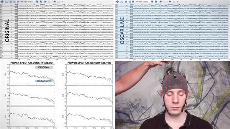 G Tec Medical Engineering Gmbh Never Stop Recording On Linkedin Eeg