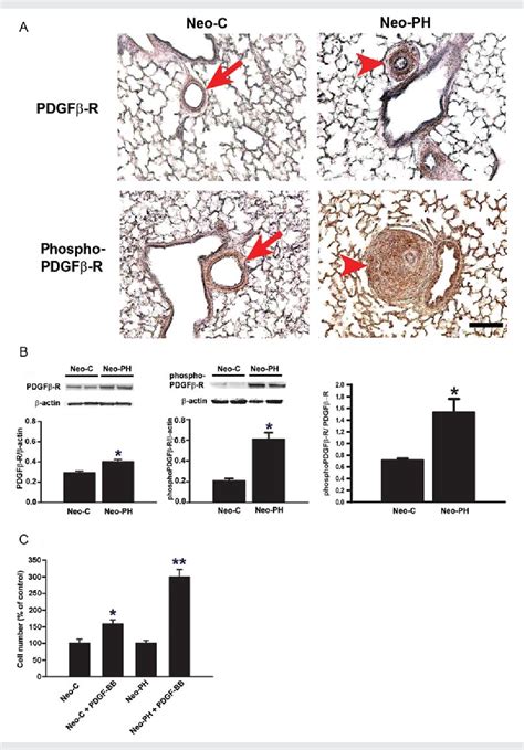 Figure 1 From Hypoxia Induces Unique Proliferative Response In Adventitial Fibroblasts By
