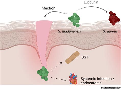 Pathogenesis For Staphylococcus Aureus