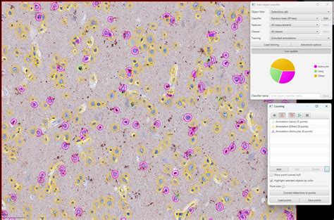 QuPath Quantification Of DAB Positive Astrocytic Structures Image Analysis Image Sc Forum