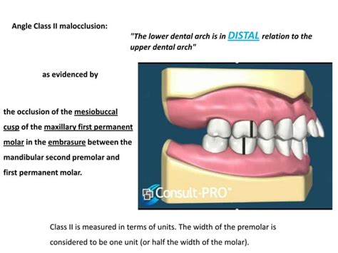 Classification Of Occlusion And Malocclusion Dr Nabil Al Zubair