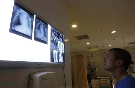 Revolutionizing Tuberculosis Detection In Vietnam Think Global Health