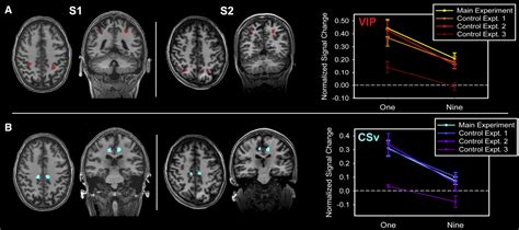 Figure 2 From The Representation Of Egomotion In The Human Brain Semantic Scholar