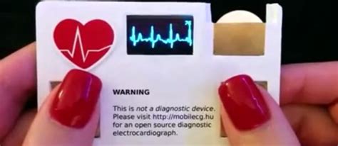 Ekg Hackaday